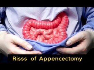 Risks of Appendectomy: What to Know Before Surgery