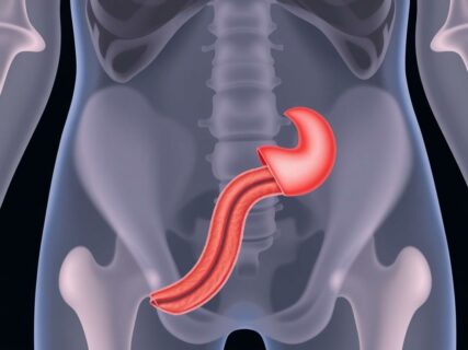 Anatomía del apéndice vermiforme: estructura y funciones